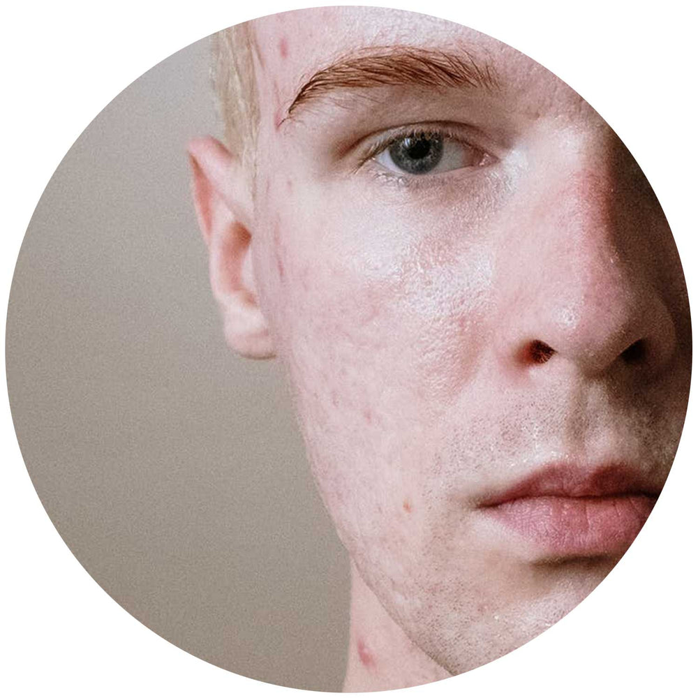 The No B.S. Guide to Skin Care – No B.S. Skin Care